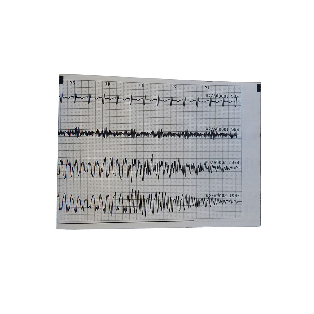 THYMATRON® SYSTEM IV - TERAPIA ELECTROCONVULSIVA